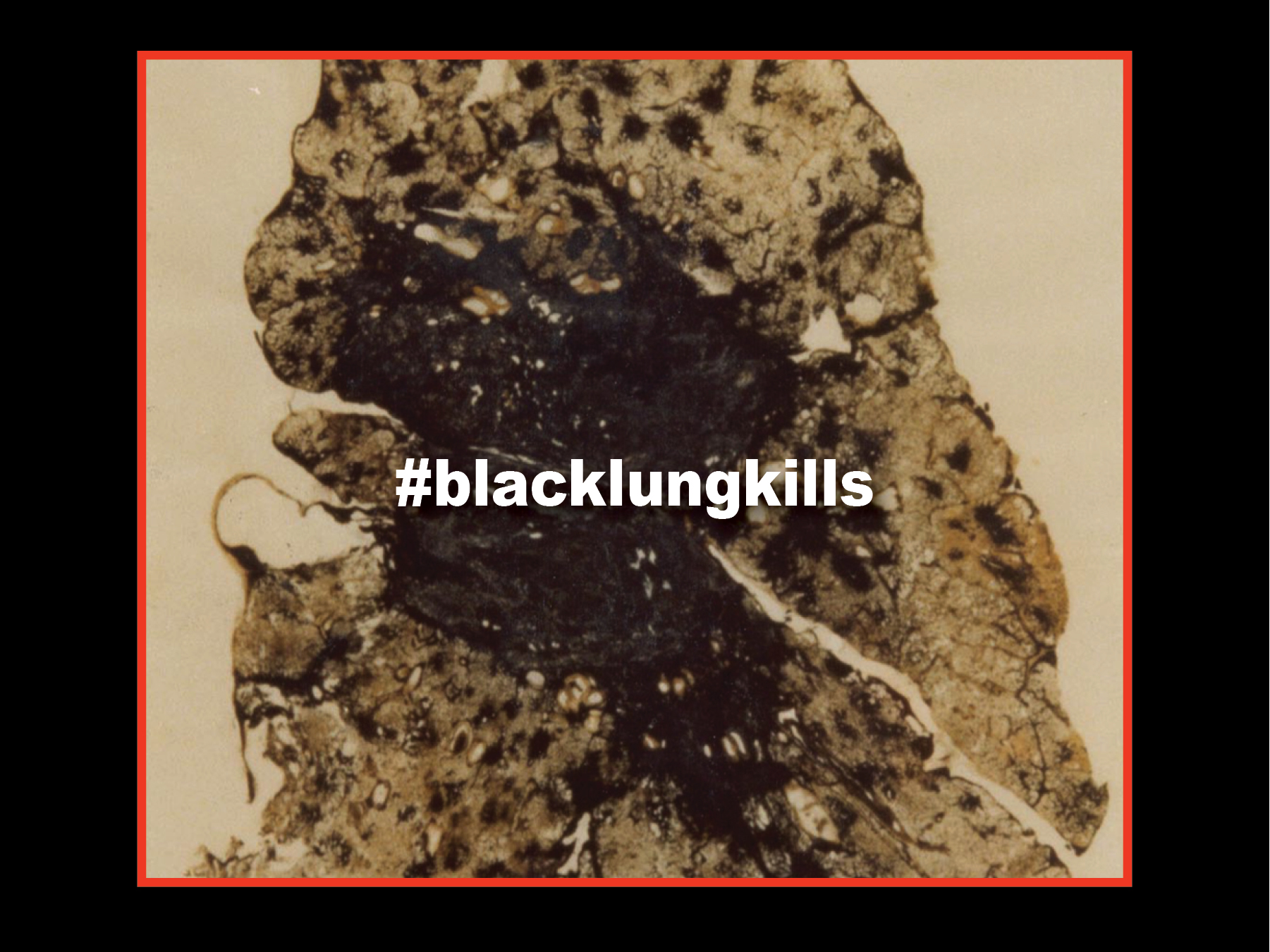 Cuts to funding for black lung benefits